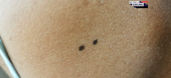 Sailing and Skin Cancer
